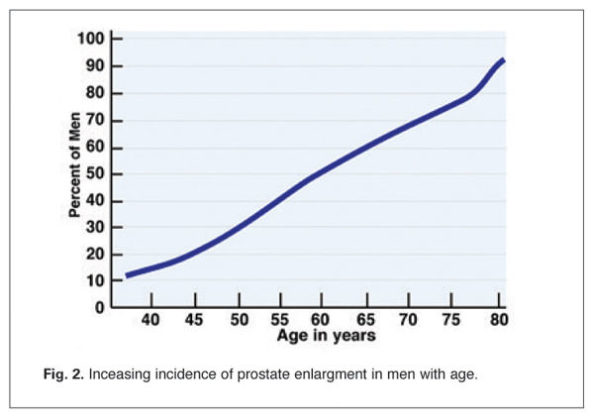 New Advances In Natural Prostate Support Nutrition Review